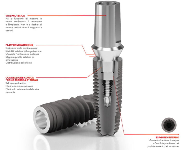 B&B Dental | Dental implants | Conexa connection