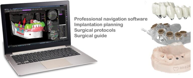 Guided Surgery Software | B&B Dental | Dental implants